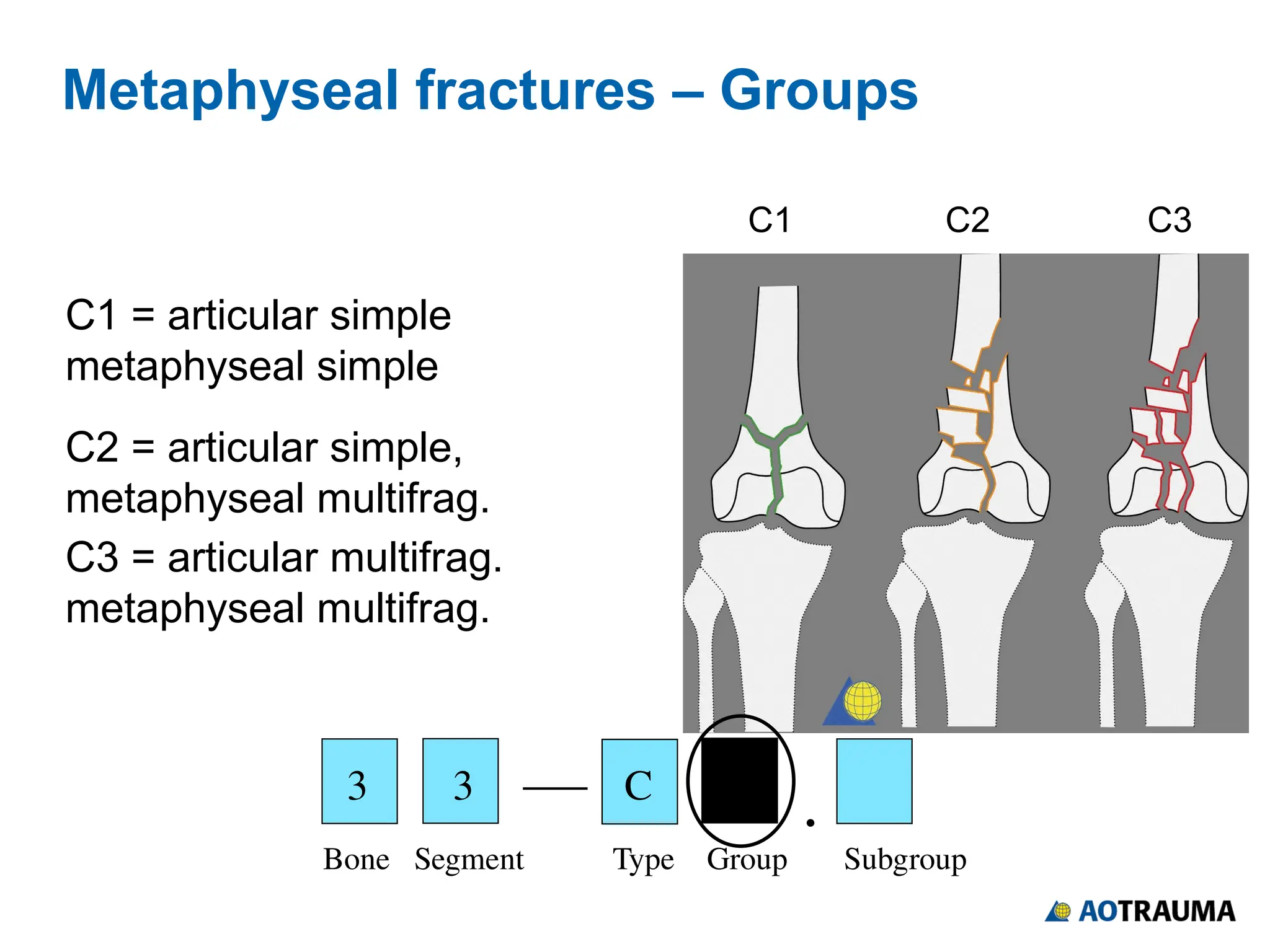 classification of fractures&$&$$$)$.pptx