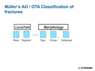 classification of fractures&$&$$$)$.pptx