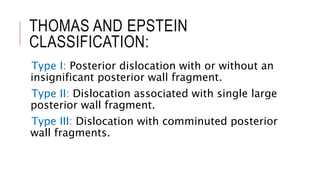 Classification of acetabular fractures | PPTX | Death, Injury, or ...