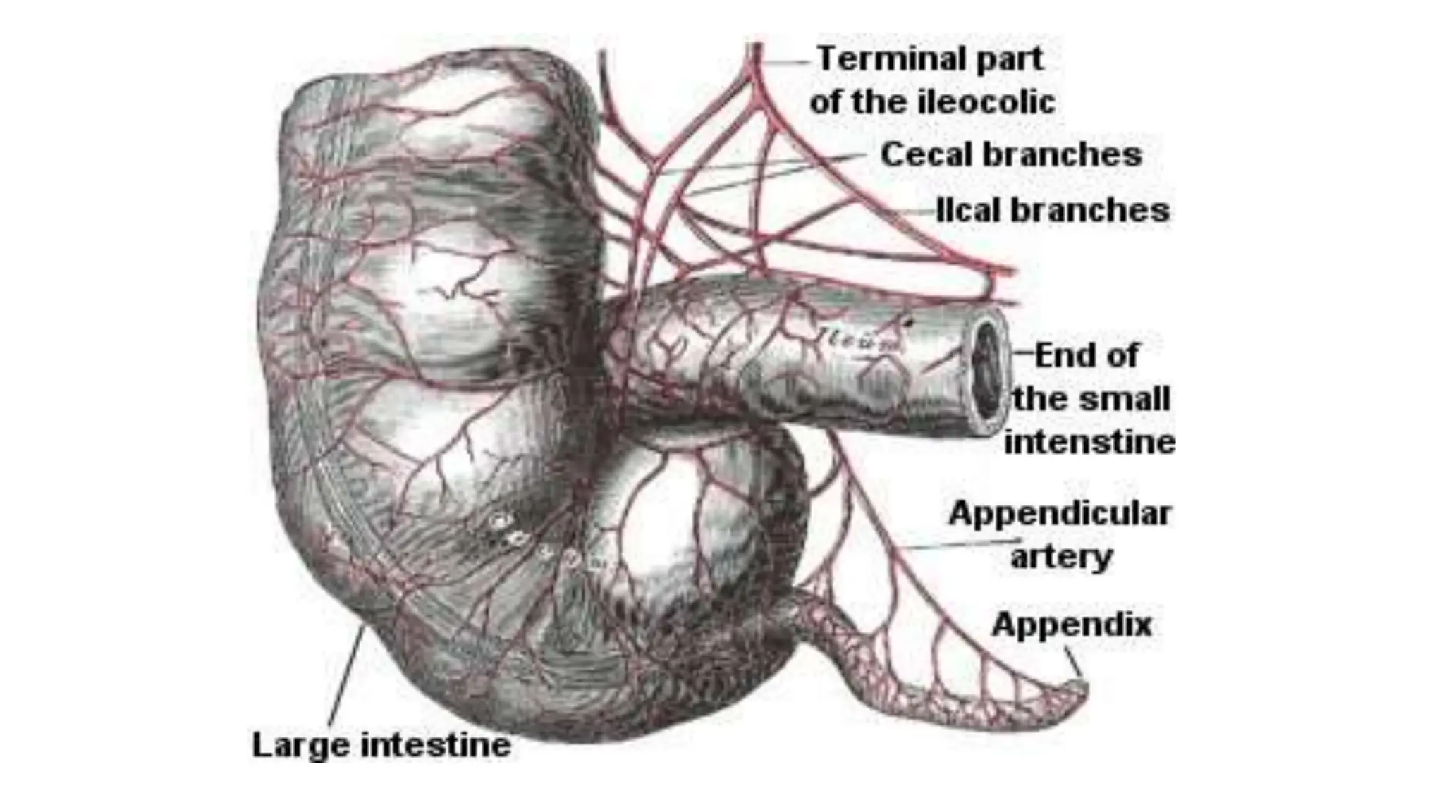 Classification of acute appendicitis.pptx