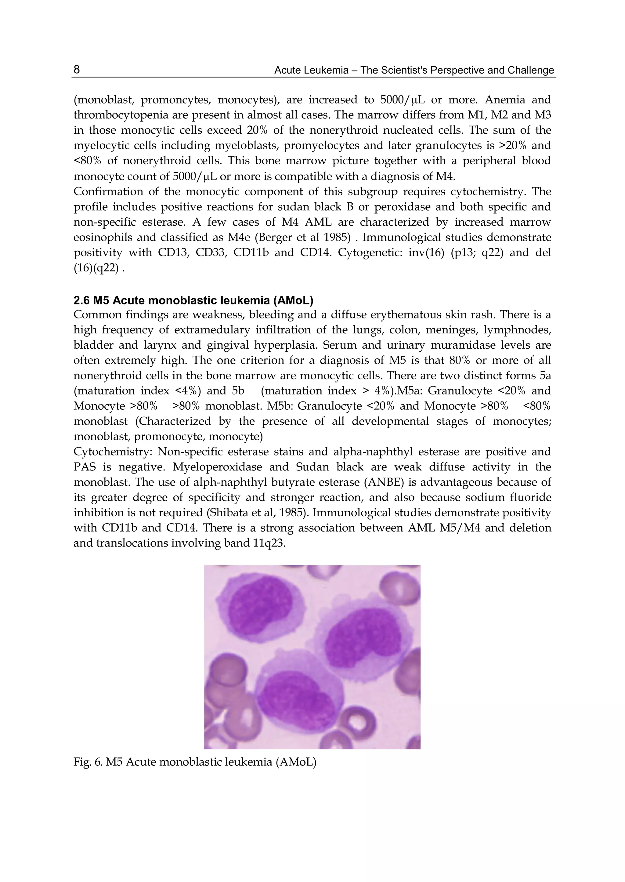 Classification of acute leukemia | PDF