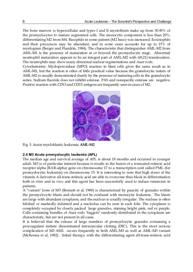 Classification Of Acute Leukemia