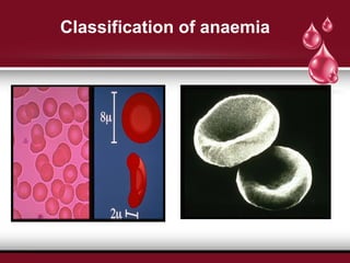 Classification of anaemia | PPT