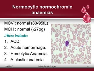 Classification of anaemia | PPT