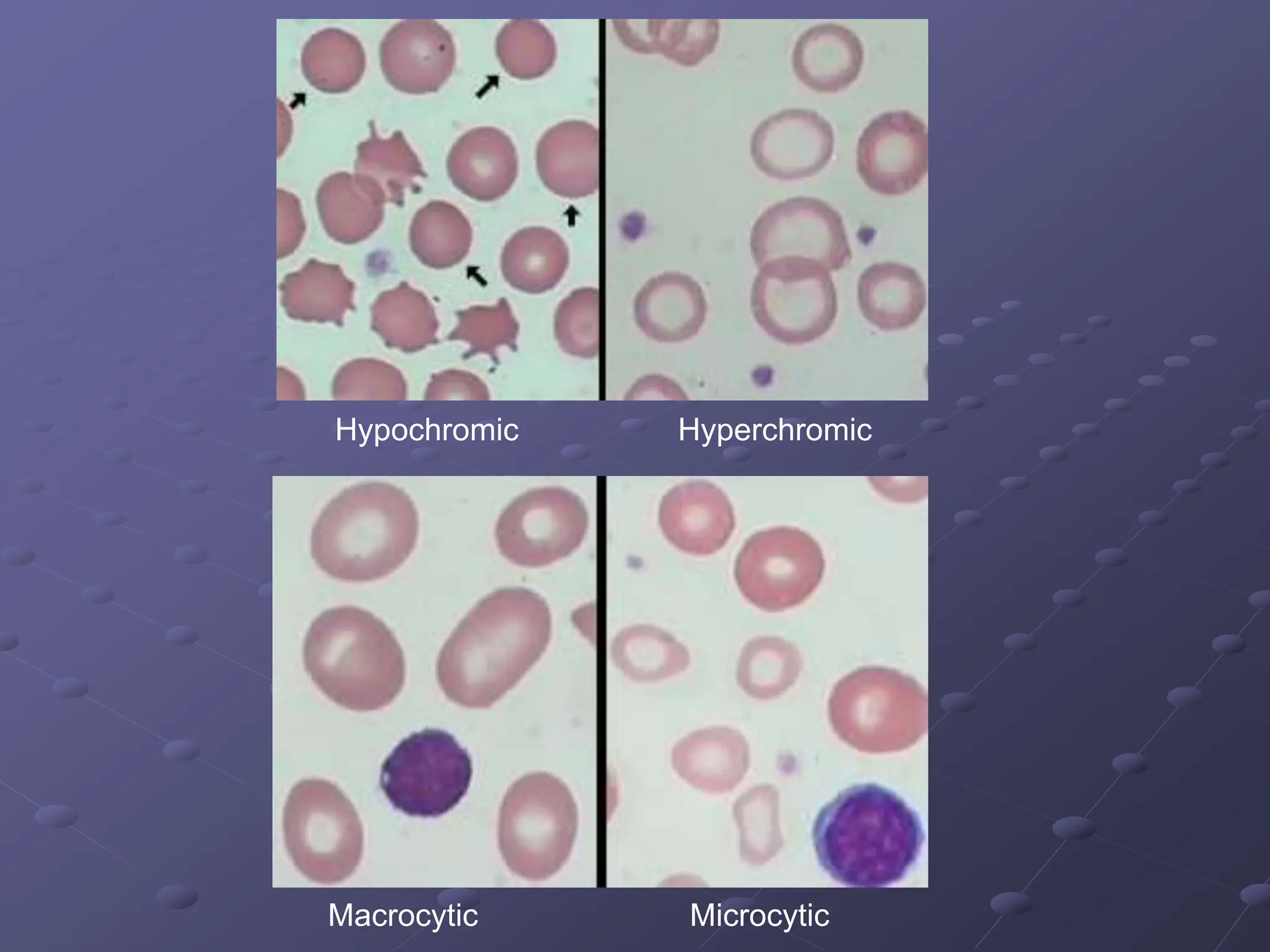 Classification of anemia123345678997.ppt