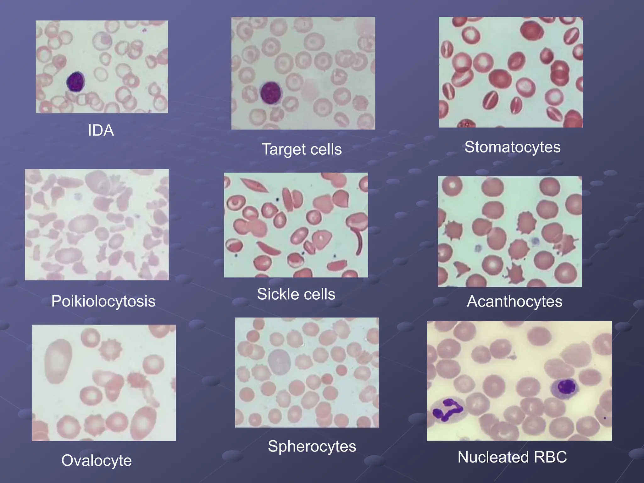 Classification of anemia123345678997.ppt