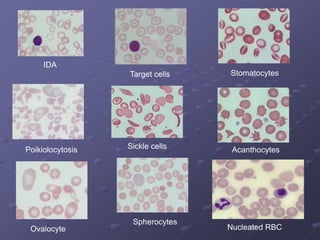 Classification of anemia123345678997.ppt