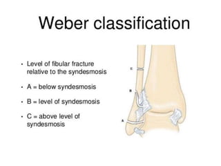CLASSIFICATION OF ANKLE FRACTURES in orthopaedics | PPTX