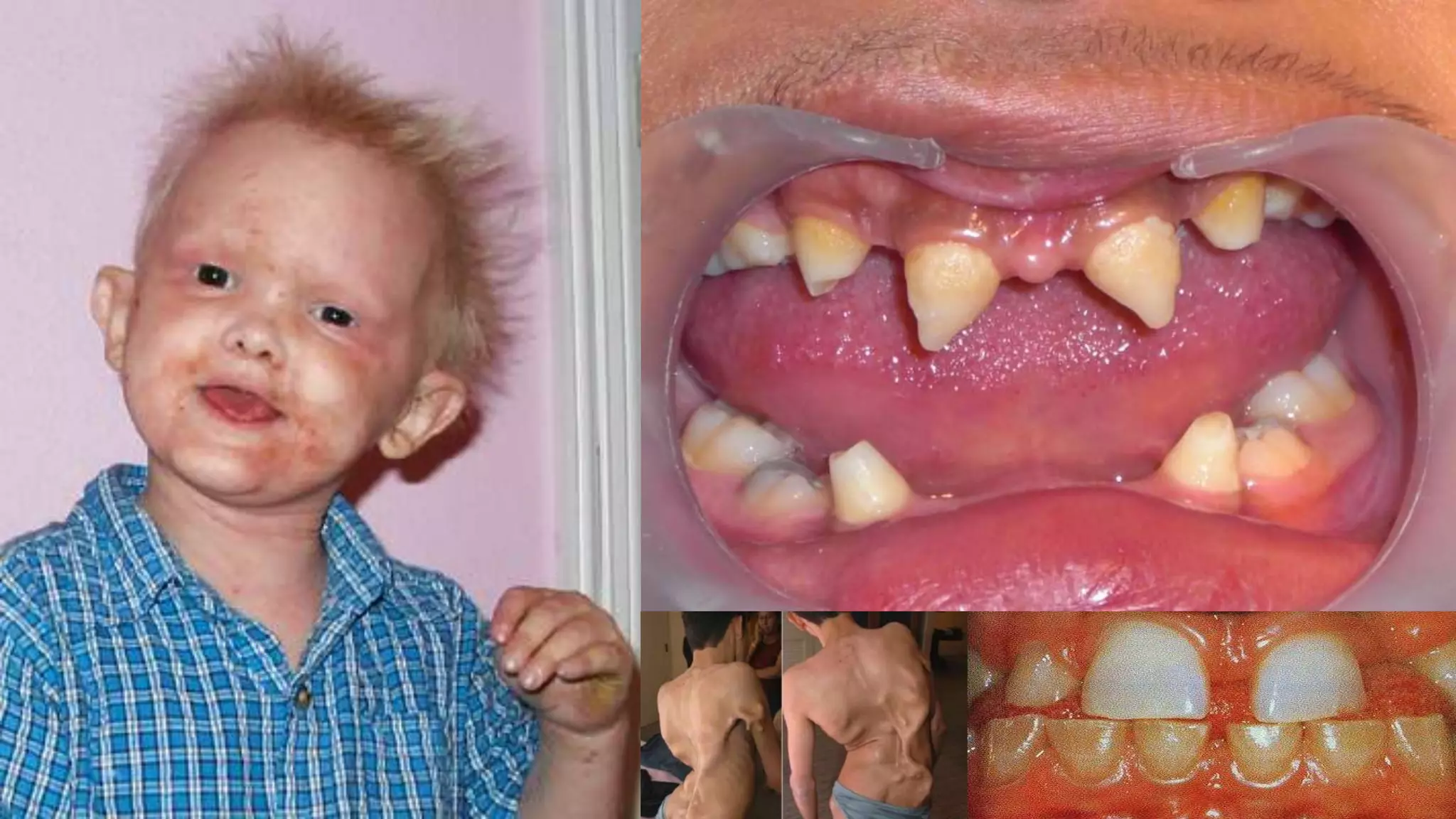 Classification of anomalies of development of human body | PPTX