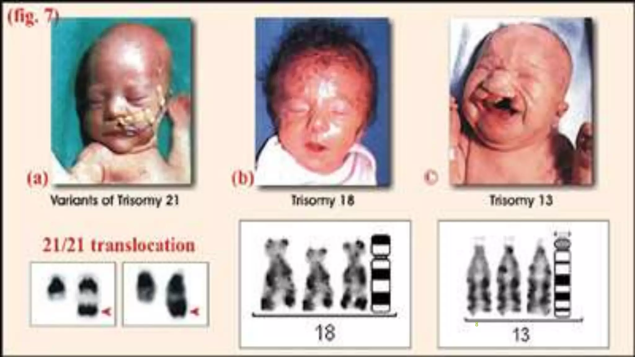 Classification of anomalies of development of human body | PPTX