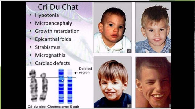 Classification of anomalies of development of human body