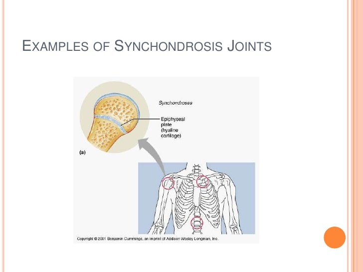 Classification of articulations