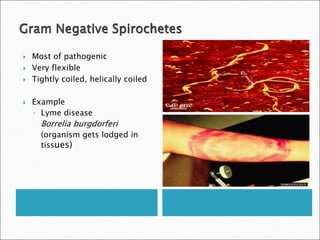 Classification of Bacteria Clinically Relevant Bacteria 092410.ppt