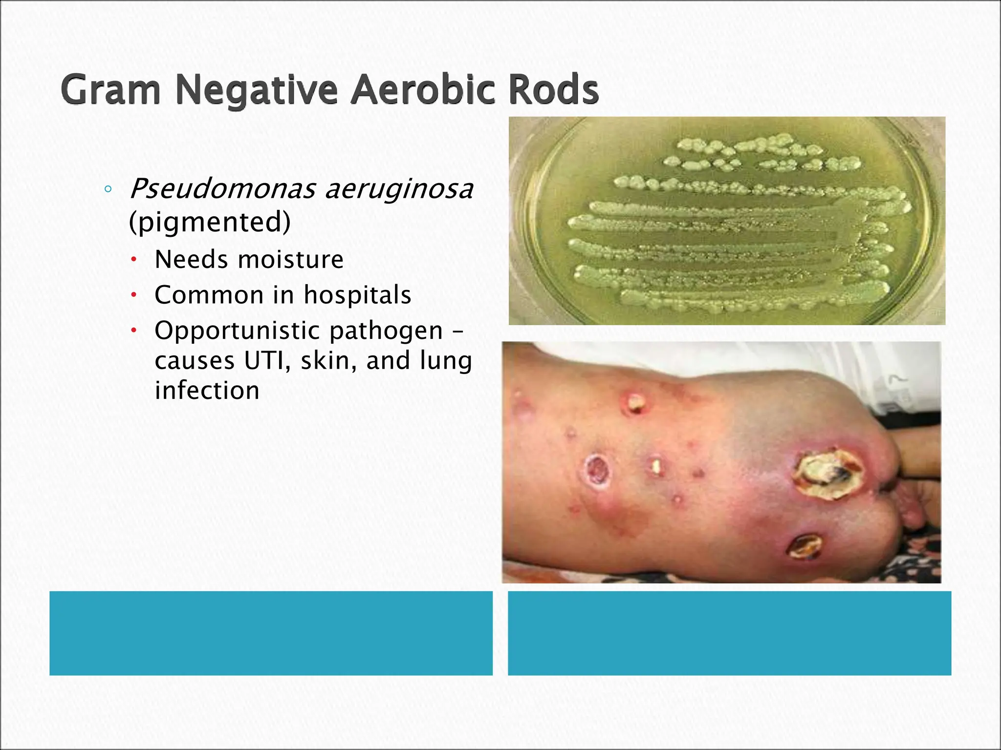 Classification_of_Bacteria_Clinically_Relevant_Bacteria_2nd_yr_MLT.pptx.ppt