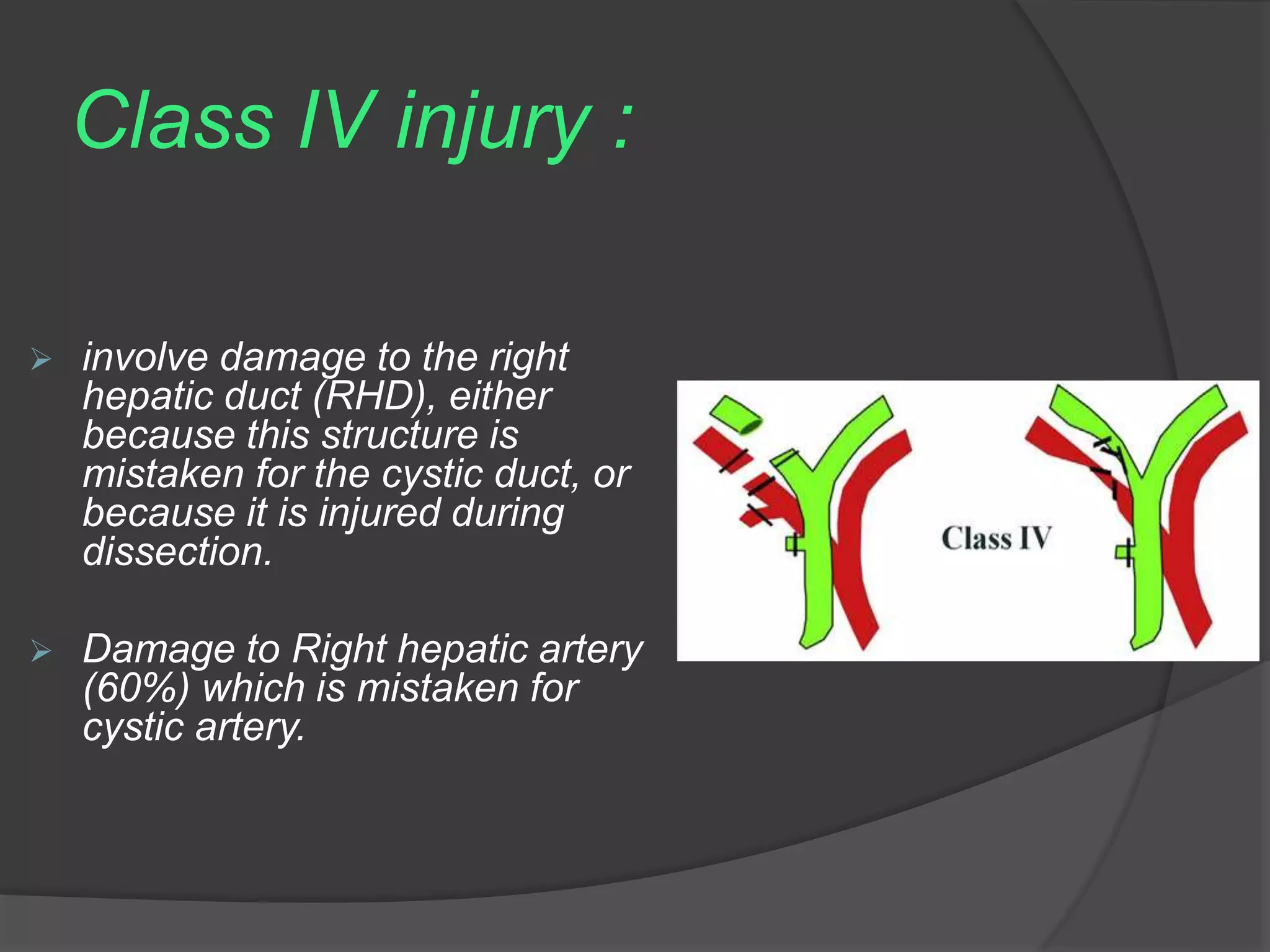 CLASSIFICATION OF BILE DUCT INJURY.pptx