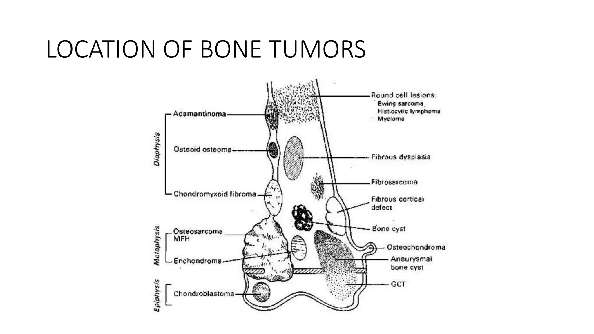 Classification of bones and Anatomy of a long bone | PPTX