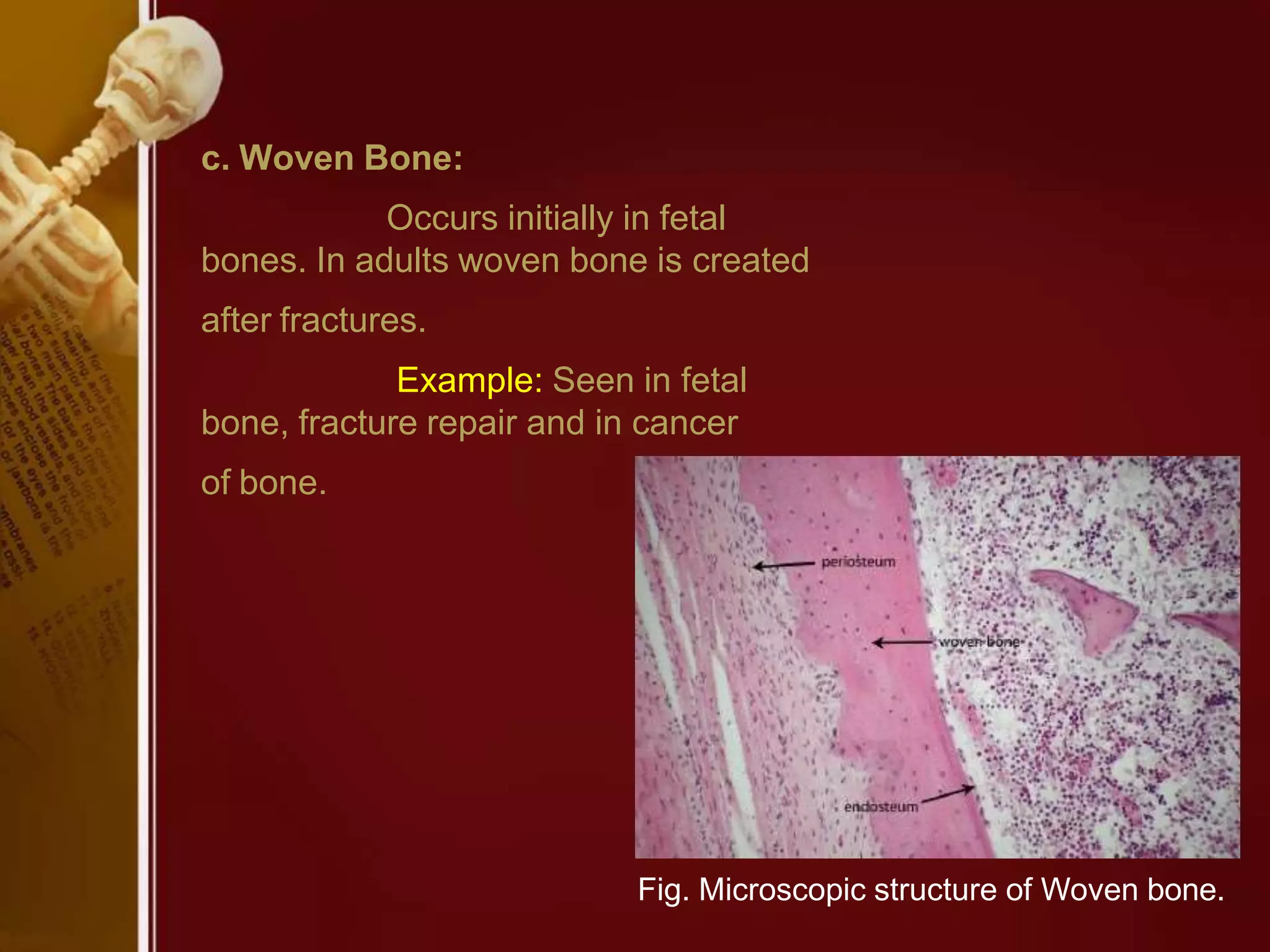 classificationofbonesanatomy-150725135414-lva1-app6891.pptx