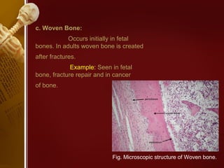 Classification of bones (anatomy) | PPT