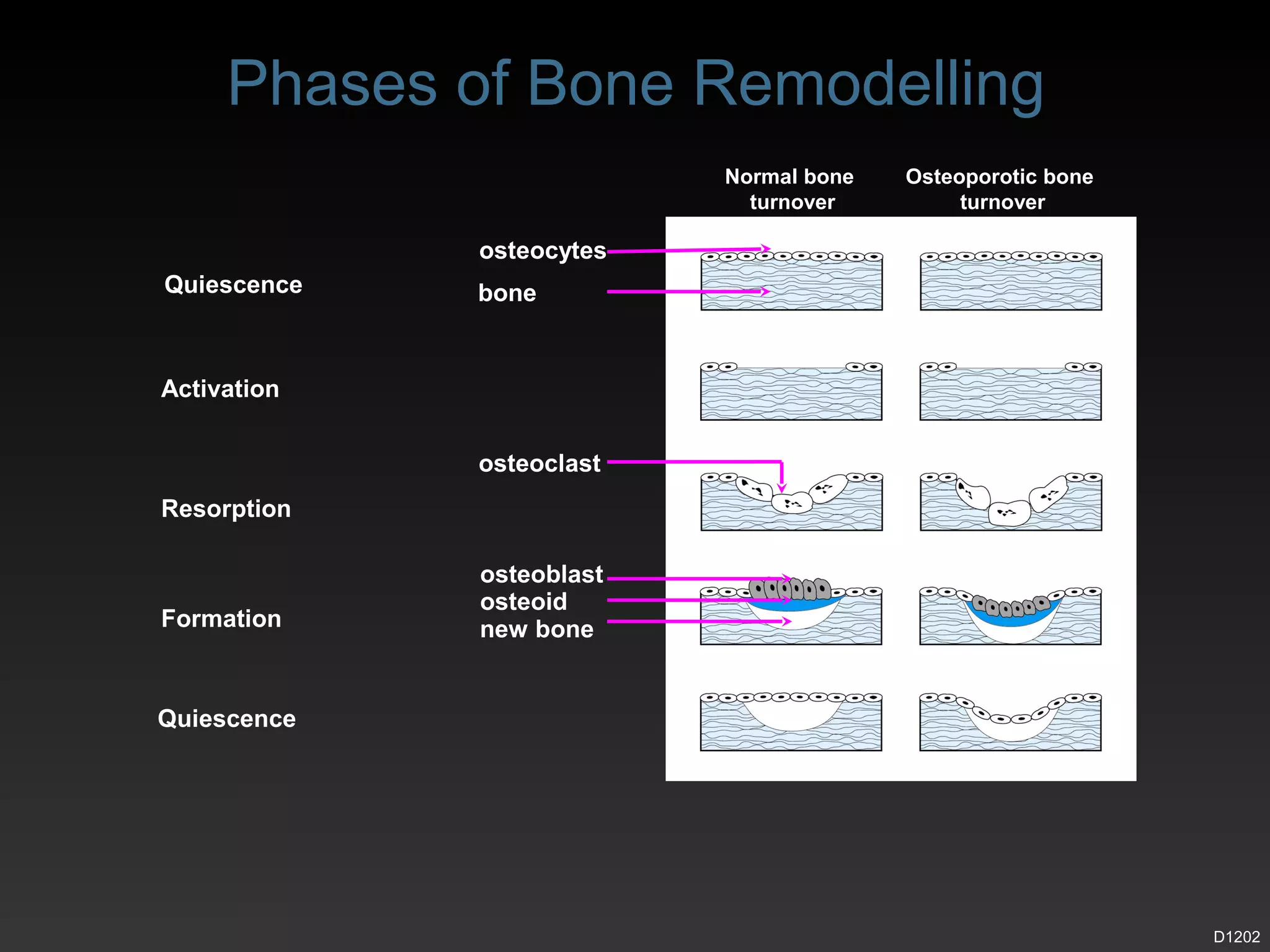 Classification of bones_and_joint_ | PPT