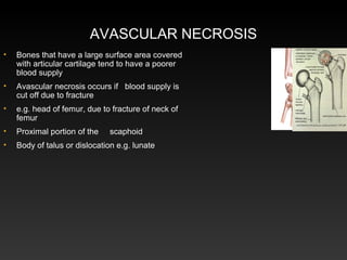 Classification of bones_and_joint_ | PPT