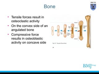 Classification of bones_and_joint_bmj | PPT