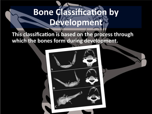 classification_of_bonesClassBon_ppt1.pptx