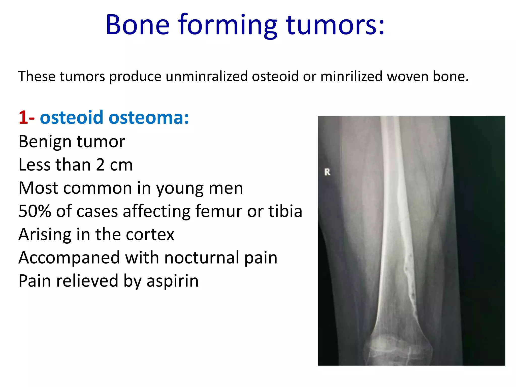 Classification of bone tumors.pptxpbl | PPTX
