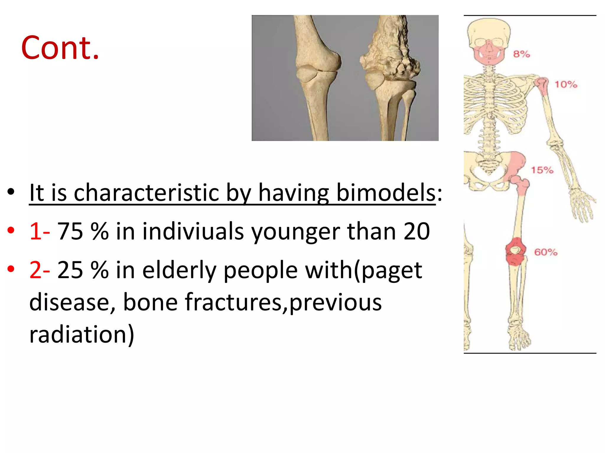 Classification of bone tumors.pptxpbl | PPTX
