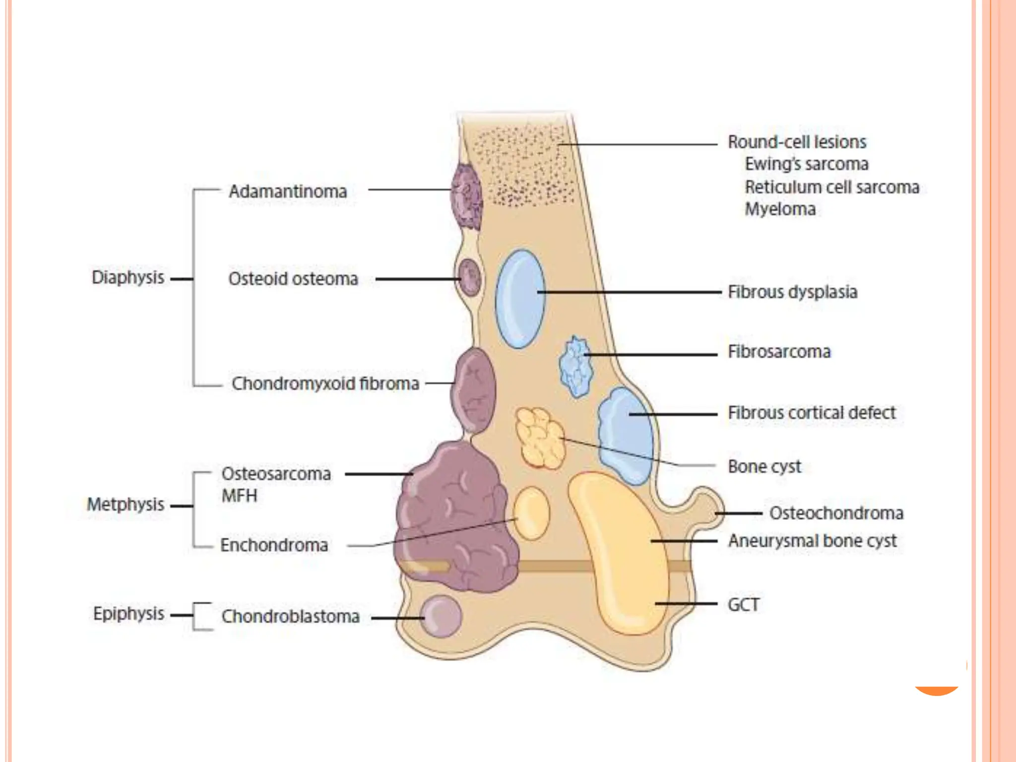 CLASSIFICATION OF BONE TUMORS & PRINCIPLES OF LIMB.pptx