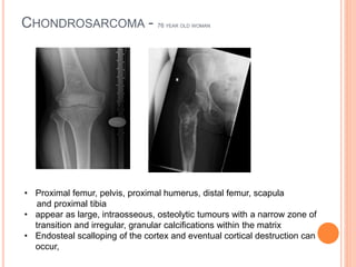 CLASSIFICATION OF BONE TUMORS & PRINCIPLES OF LIMB.pptx