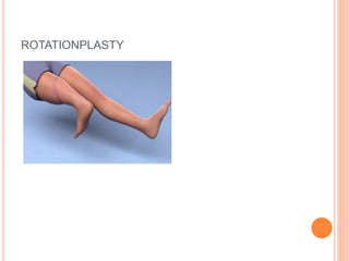 CLASSIFICATION OF BONE TUMORS & PRINCIPLES OF LIMB.pptx