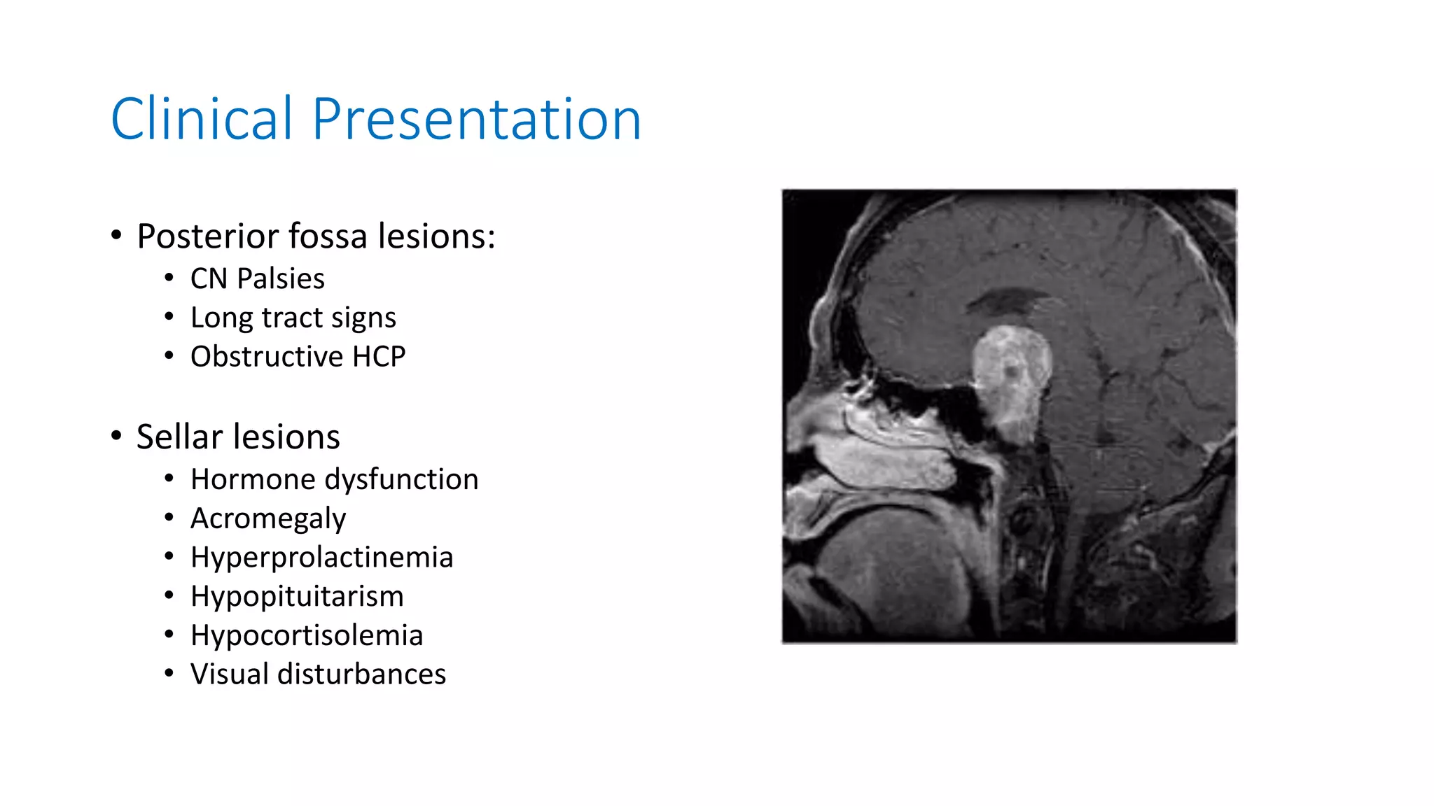 2021 WHO Classification of brain tumours.pptx
