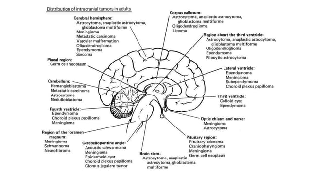 2021 WHO Classification of brain tumours.pptx