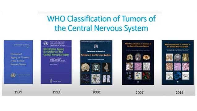 2021 WHO Classification of brain tumours.pptx
