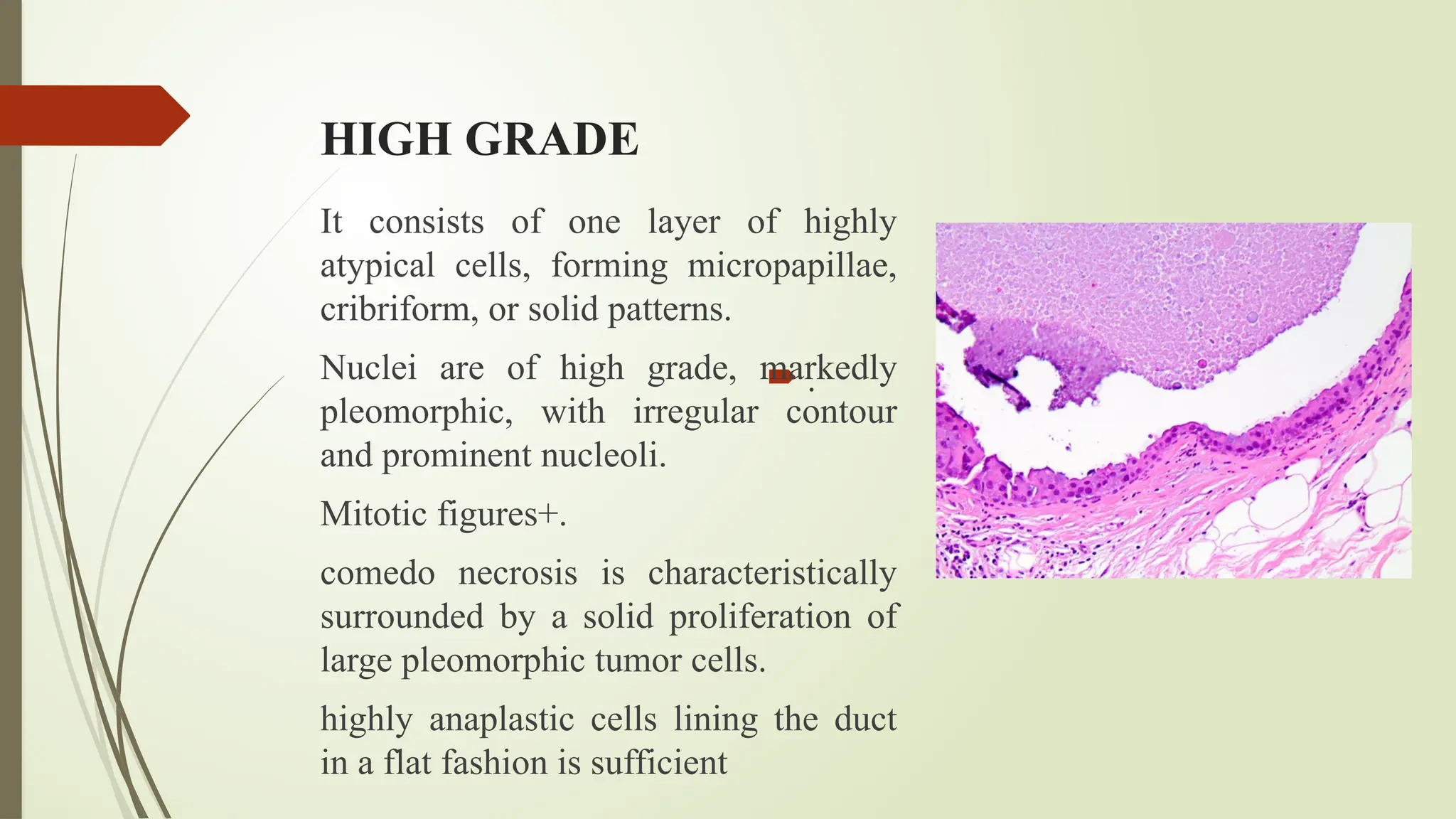 CLASSIFICATION OF BREAST TUMORS (1).pptx