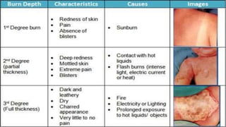 Classification of burn by dr. ali mujatba | PPTX