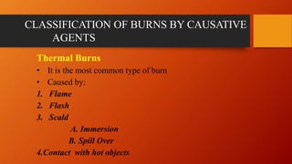 Classification of burn by dr. ali mujatba | PPTX