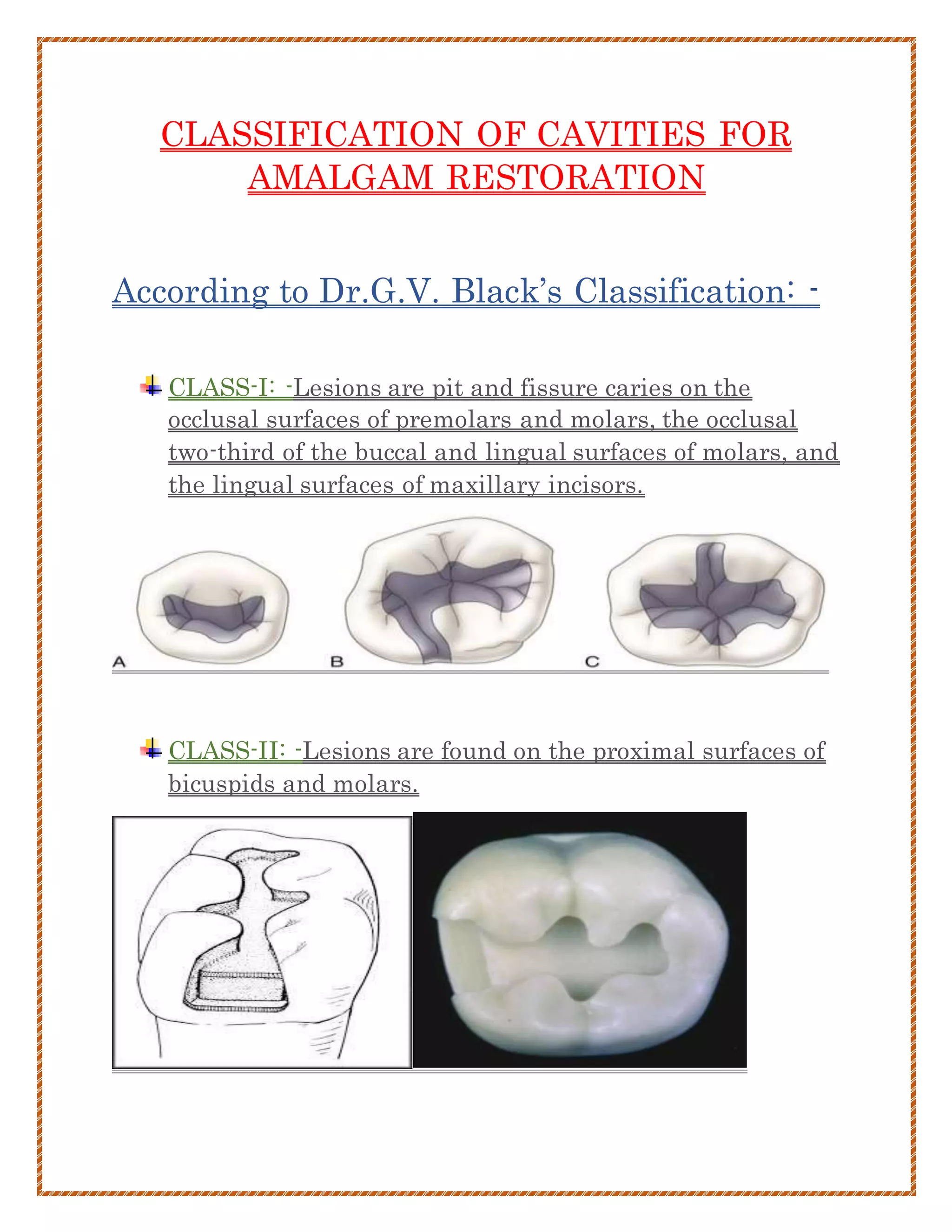 Classification of cavities | DOCX