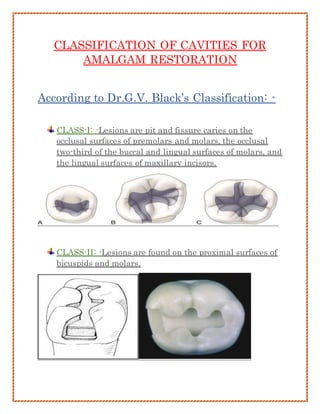 Classification of cavities | DOCX