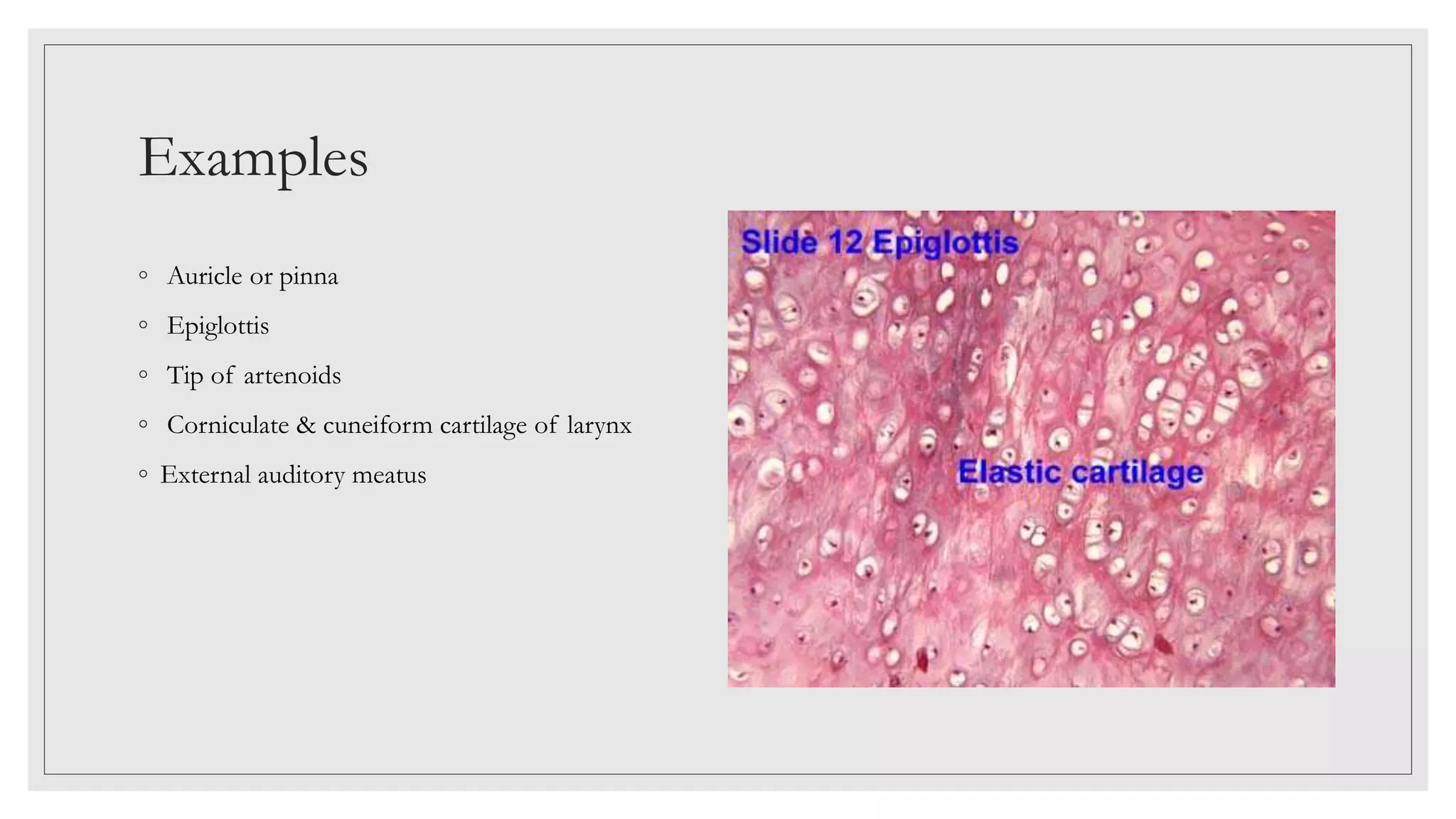 Classification of cartilage.pptx