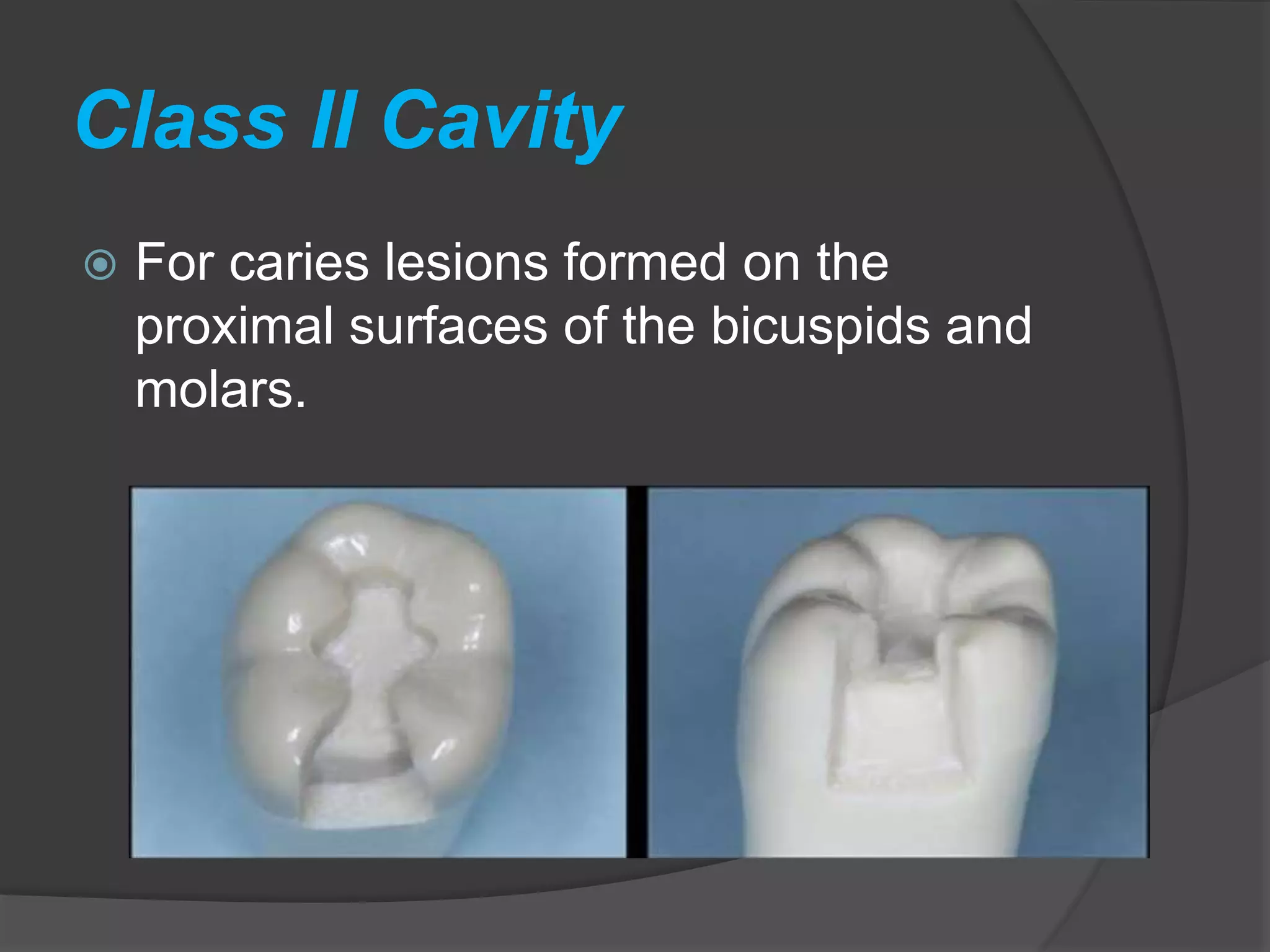 Classification of cavity cutting | PPTX