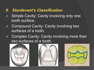 Classification of cavity cutting | PPTX