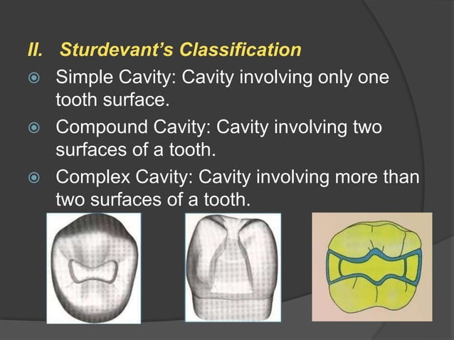 Classification of cavity cutting | PPTX | Dental Health | Diseases and ...