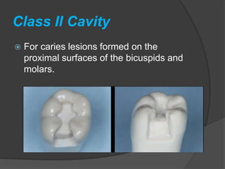 Classification of cavity cutting | PPTX