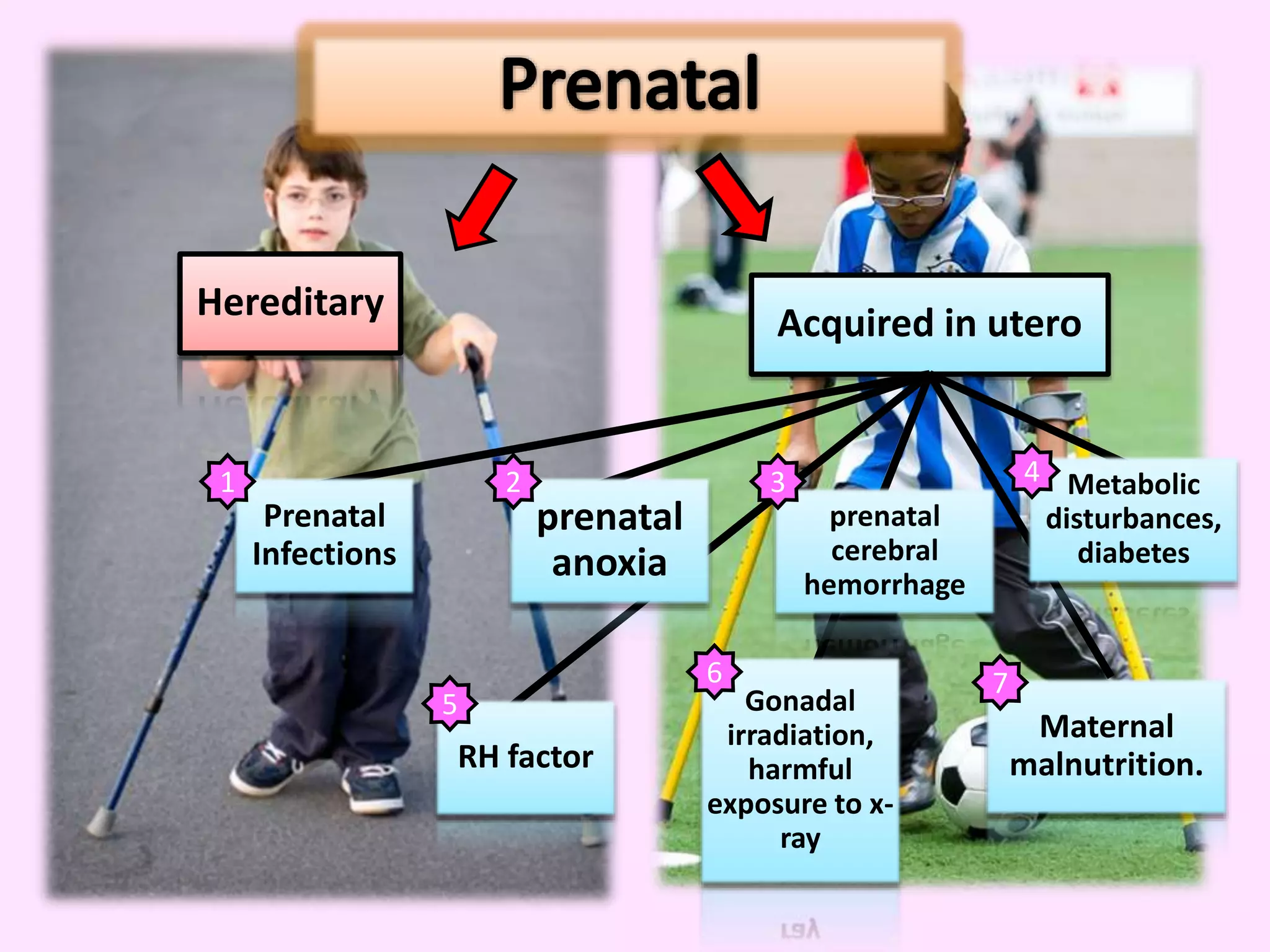 Classification of cerebral palsy | PPTX