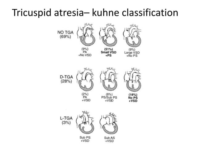 Classification of chd | PPTX