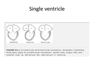 Classification of chd | PPTX