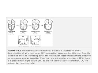 Classification of chd | PPTX