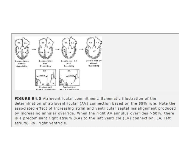Classification of chd | PPTX