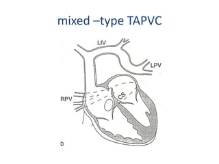 Classification of chd | PPTX